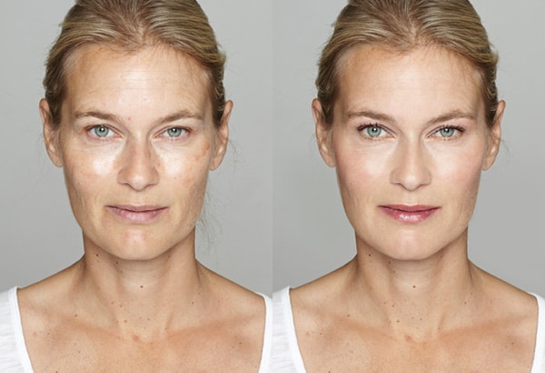 Rejuvenarea facială sau cum să arăți mai tânăr - Doctor SKin