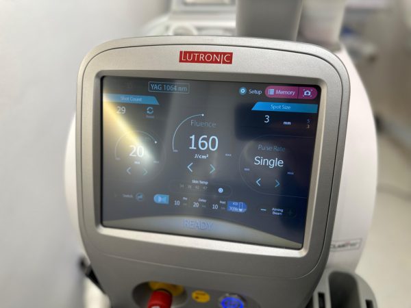 Tratament laser leziuni vasculare, cuperoză, rozacee⚡️Doctor SKiN